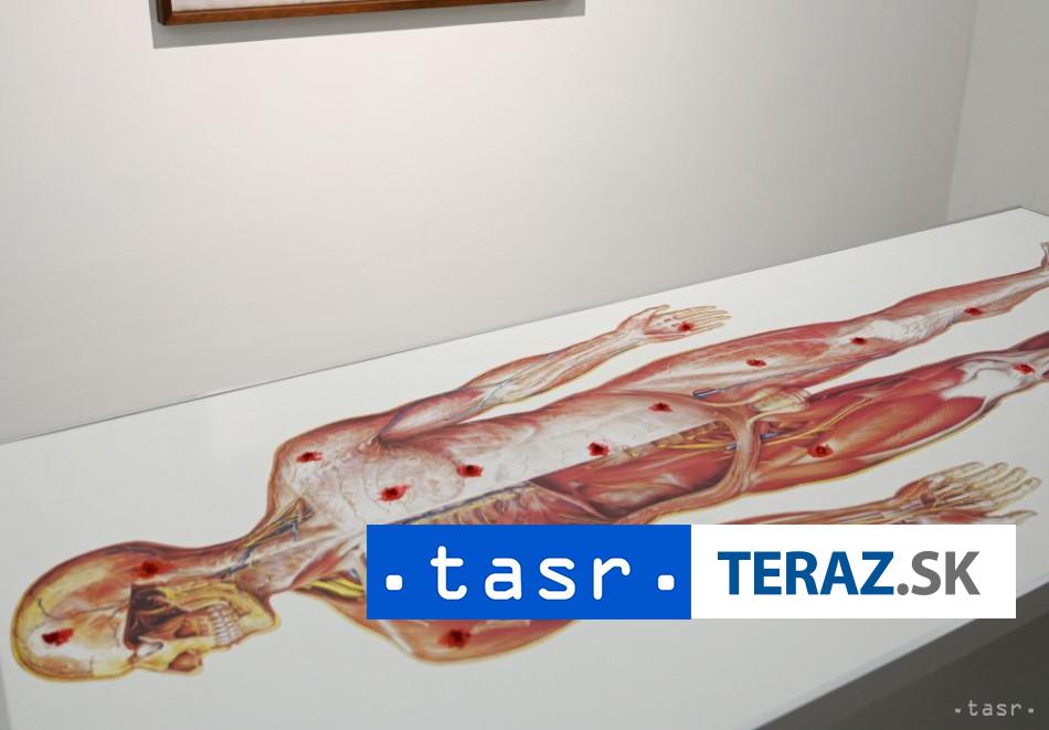 OTESTUJTE SA: Ako dobre poznáte vlastné telo?